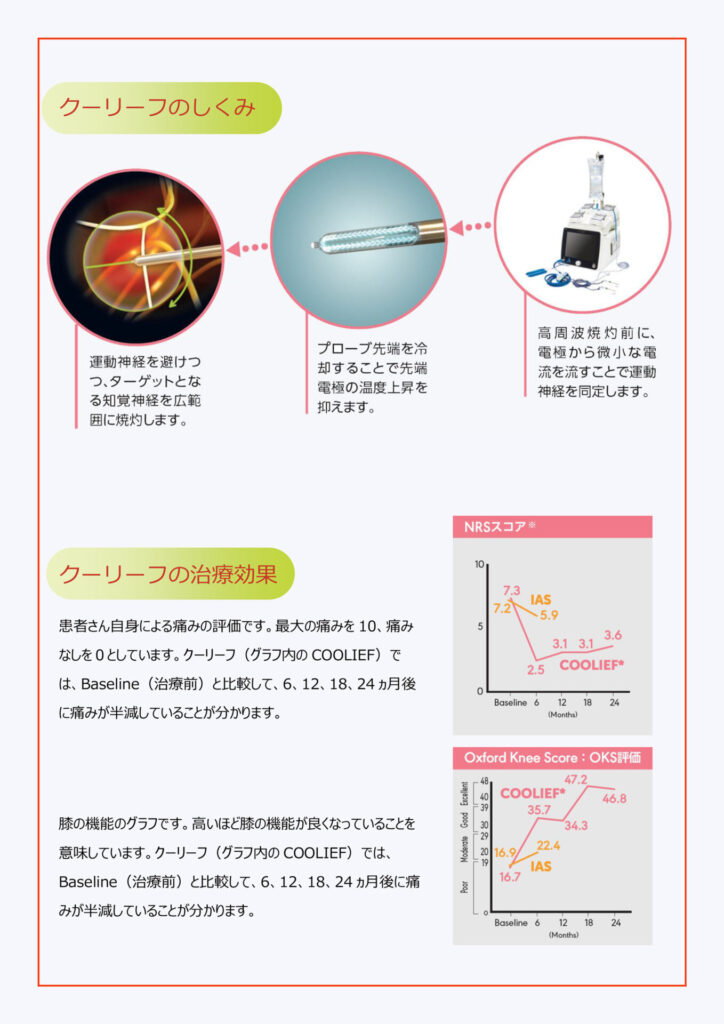 クーリーフ(COOLIEF) - 変形性膝関節症に対する新しい治療法 - 永井整形外科医院｜香川県坂出市
